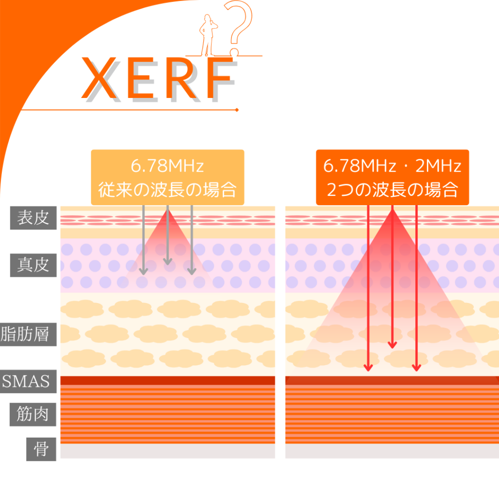 XERF(ザーフ)について Column | 銀座1丁目の美容アンチエイジングクリニック Clinic K