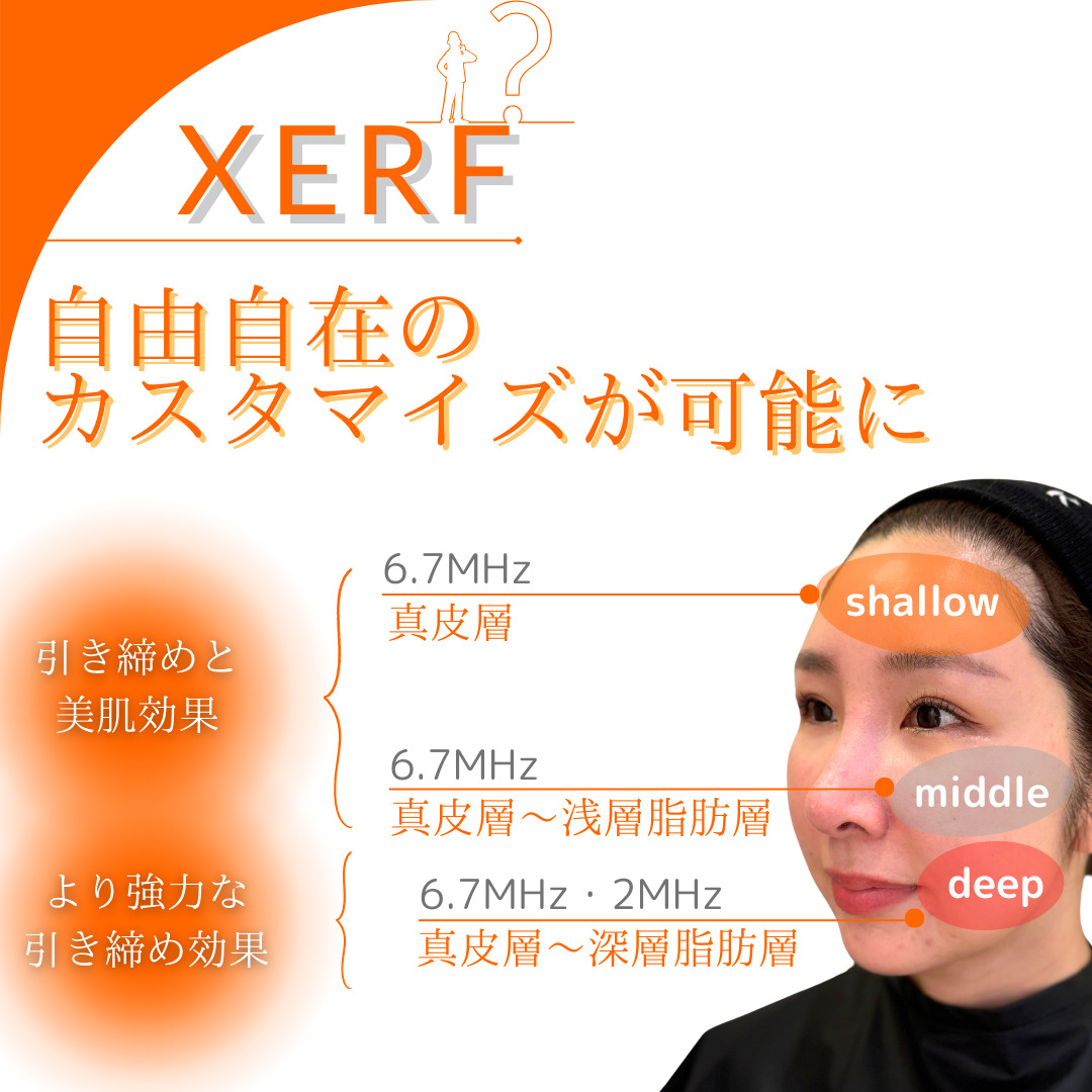 XERF(ザーフ)について Column | 銀座1丁目の美容アンチエイジングクリニック Clinic K